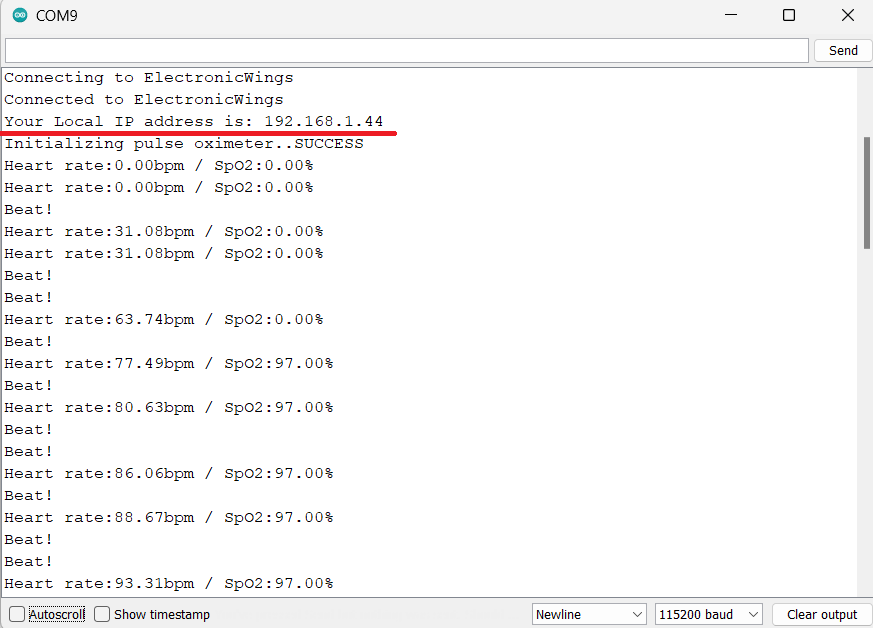 MAX30100 Pulse Oximeter Interfacing with ESP32 | ESP32