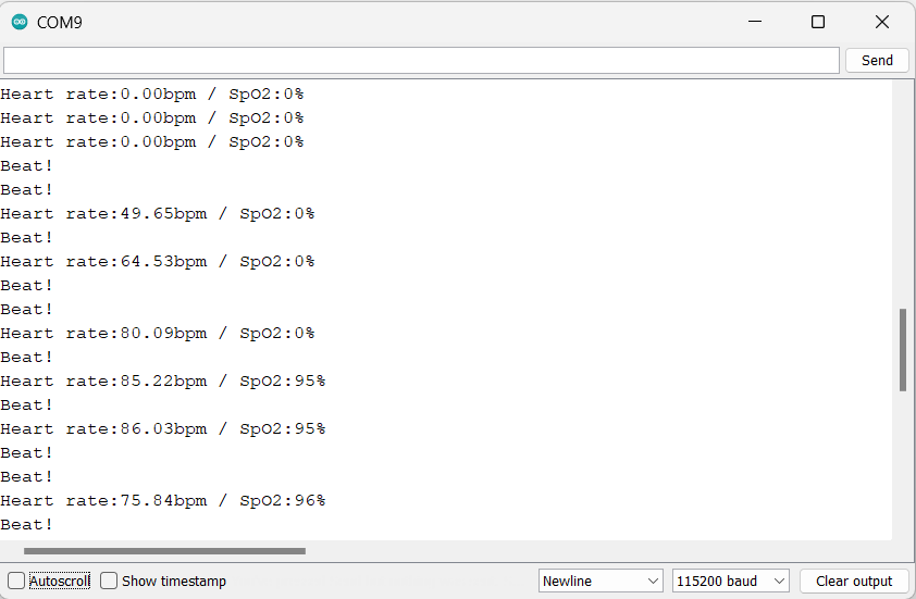 MAX30100 Pulse Oximeter Interfacing with NodeMCU | NodeMCU