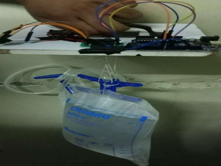 Urine bag detector | project