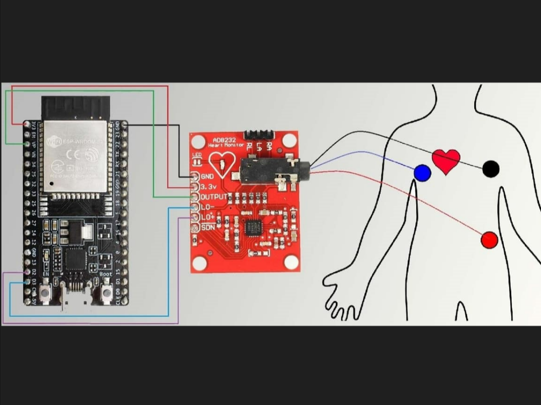 IoT based ECG Monitoring System | project