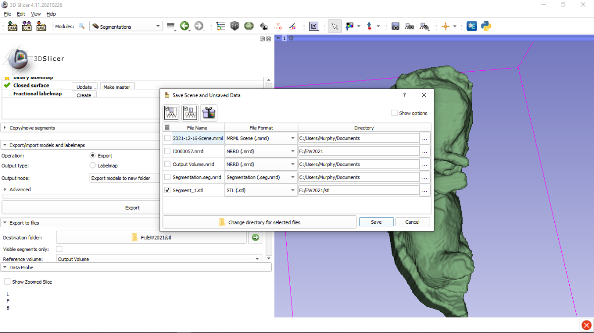 3D Printing a ultrasonography file | project